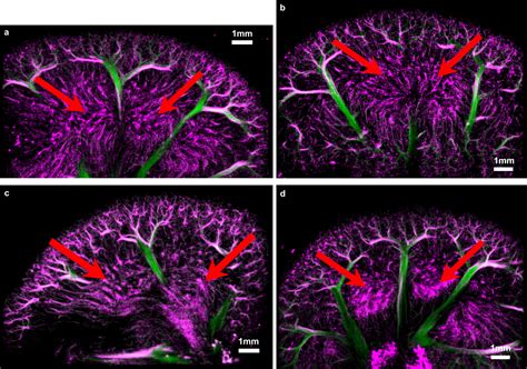 Sensing Ultrasound Localization Microscopy For The Visualization Of