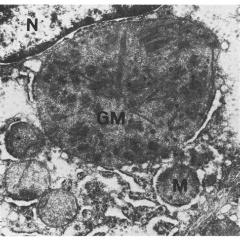Part Of Mitochondrium With Large Dense Intramitochondrial Granules