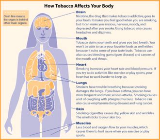 Women And Smoking Wikipedia
