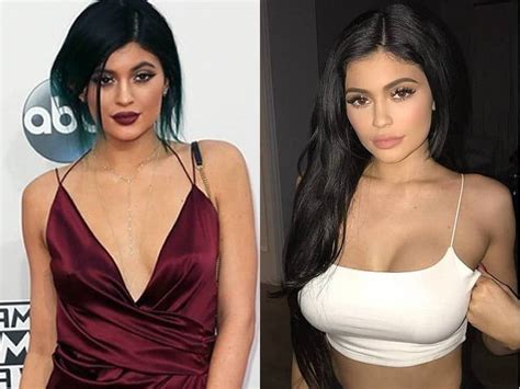 Kylie Jenner Before And After Transformation