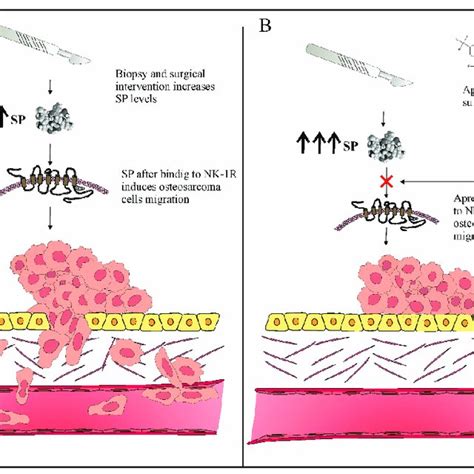 A Surgical Procedures Biopsy Or Surgical Intervention Can Induce