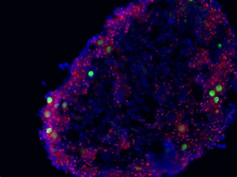 Alg13 Antibody 20810 1 Ap Proteintech