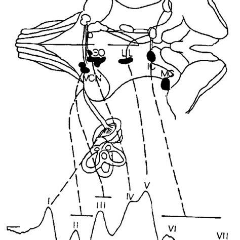 The Resulting Electrical Response In The Auditory Nerve And Brainstem