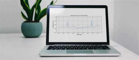 Atrial Fibrillation Detection Using Machine Learning Medrecord