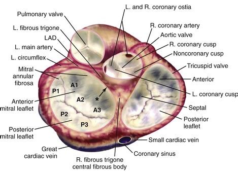 Aortic Mitral Curtain