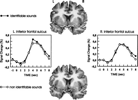 Functional Asymmetry Of Human Prefrontal Cortex Encoding And Retrieval Of Verbally And