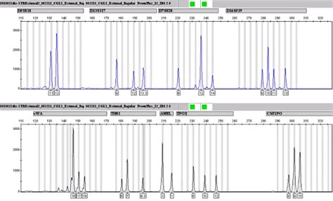 Str Profile Of Cgl1 This Str Profile Example Featuring Cgl1 Reveals