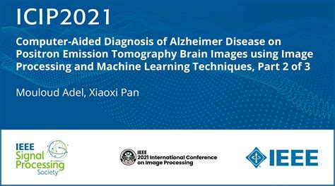 Computer Aided Diagnosis Of Alzheimer Disease On Positron Emission Tomography Brain Images Using