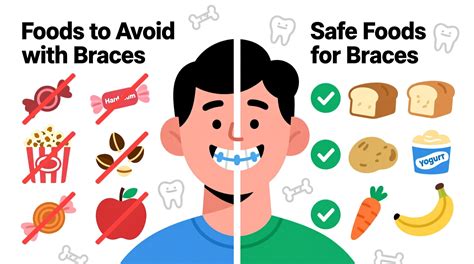 Foods To Avoid With Braces Complete Safety Guide