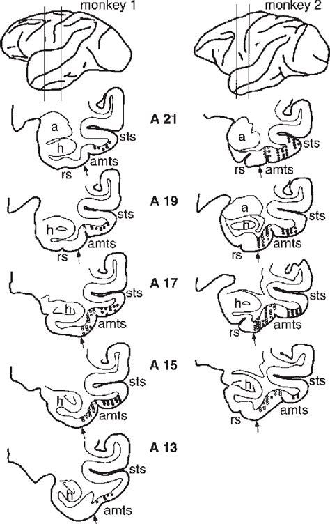 Figure 1 From Visual Response Properties Of Cells In The Ventral And Dorsal Parts Of The Macaque