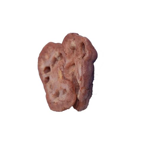 China Renal Tuberculosis Pathology Model Manufacturers Suppliers Factory Meiwo