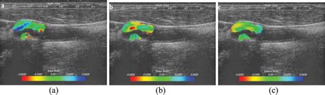 Axial A Lateral B And Shear C Strain Images In The Segmented