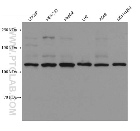 Fgfr3 Antibody 66954 1 Ig Proteintech