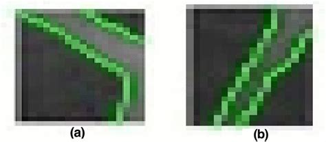 segmentation of fig 6b d after 100 iterations using the proposed