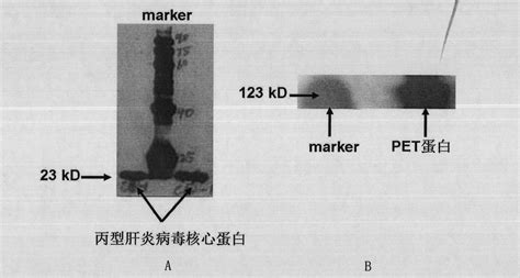 Nucleic Acid Aptamer Specifically Combined With Hepatitis C Virus Core Protein And Application