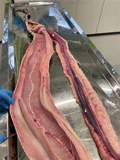 Can Anybody Please Help Me Identify These Body Parts In A Dissection Of