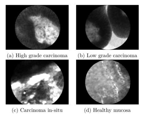Example Of Each Class From Cystoscopy Data Set Download Scientific Diagram