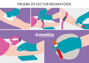 Factor Reumatoide Definición Enfermedades Y Análisis Clínicos Meditip