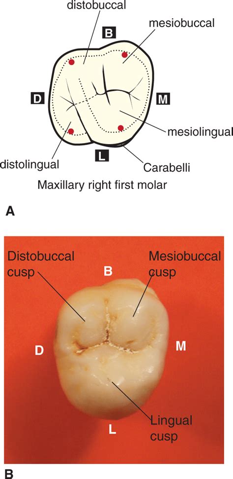 Largest Cusp Of Maxillary First Molar At Carmen Zandra Blog
