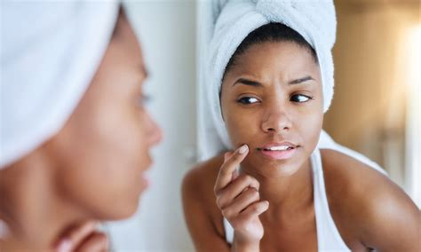 Hyperpigmentation Vs Erythema How To Inform Which You Have Spiritism