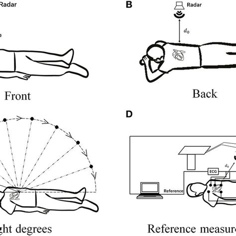 Schematic Diagram Of Multiscale Detection Of A Cardiac Signal A