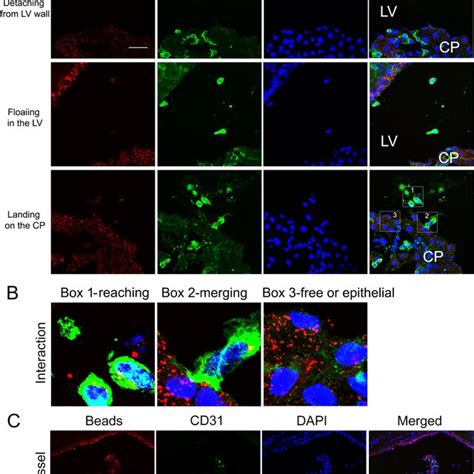 Commutation And Interaction Of Beads Ependymal Cells And The Choroid