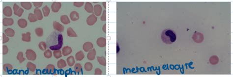 Leukocytes To Leukogram Flashcards Quizlet