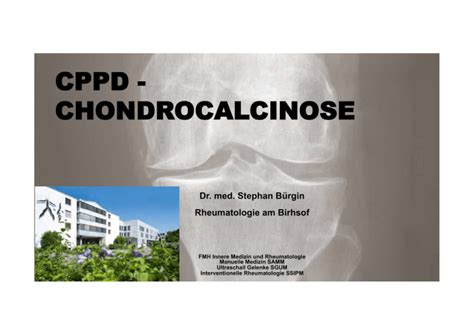 Chondrocalcinose