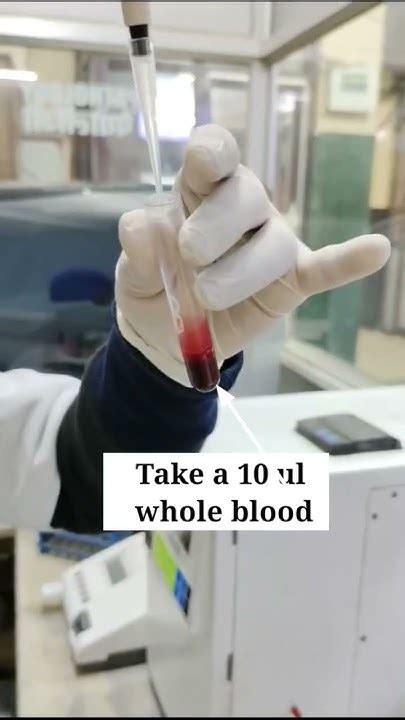 Cyanmethemoglobin Method 🔬💉 Shorts Youtubeshorts Test Bloodtest