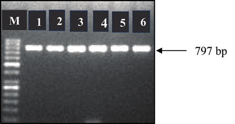 Pcr Amplicon Of Part Of 5utr Exon 1 And Part Of Intron 1 Of Mstn