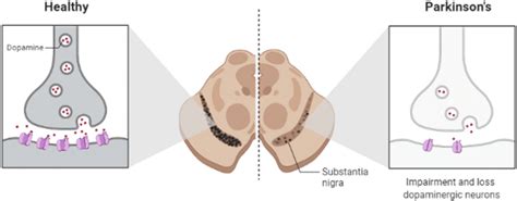 A Schematic Diagram Of Substantia Nigra Pars Compacta Region Of Healthy