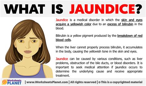 What Is Jaundice Definition Of Jaundice