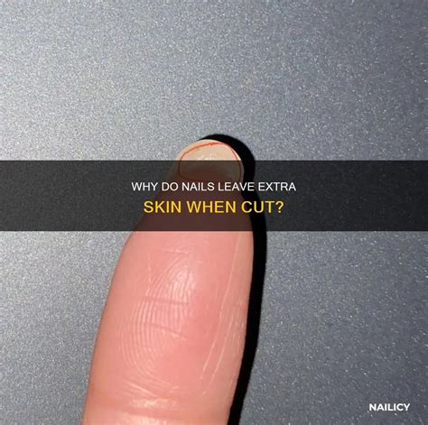 Why Do Nails Leave Extra Skin When Cut Nailicy