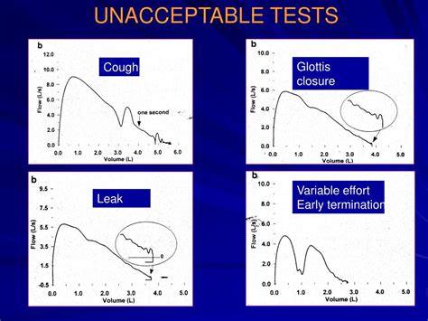 Ppt Pft Standards And Interpretation Recommendations Of Recent