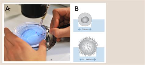 Figure 2 From Microinjection In Early Embryos Of Zebrafish And Medaka