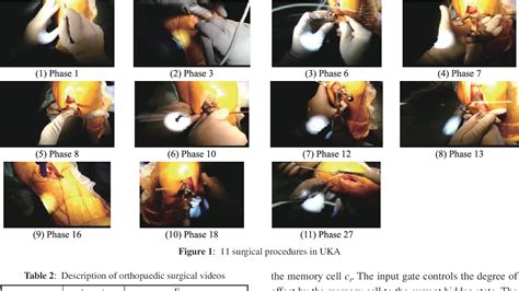 Table 1 From Surgical Phase Recognition With Wearable Video Camera For