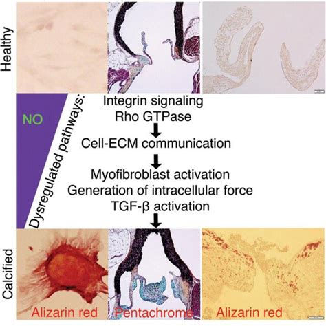 Nitric Oxide No Inhibits The Process Of Aortic Valve Calcification Download Scientific