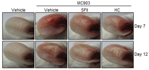 Calcipotriol Mc903 Induced Atopic Dermatitis Ad Model Creative Bioarray Creative Bioarray