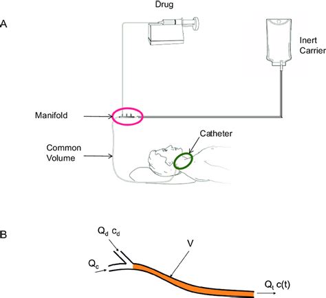 Drug Infusion System Architecture A Modern Drug Infusion Systems