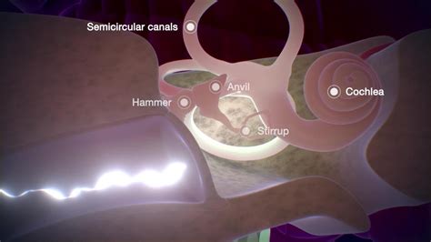 Otitis Media Chronic Suppurative Ear Nose And Throat Disorders