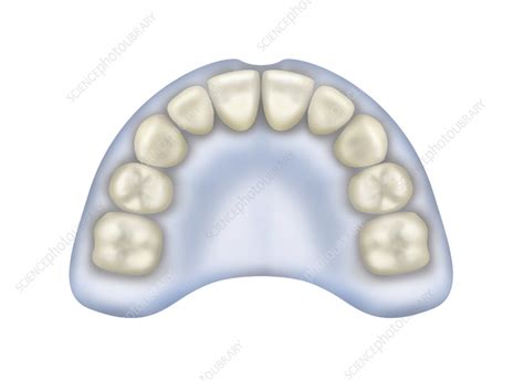 Upper Jaw Denture Illustration Stock Image C061 1851 Science Photo Library
