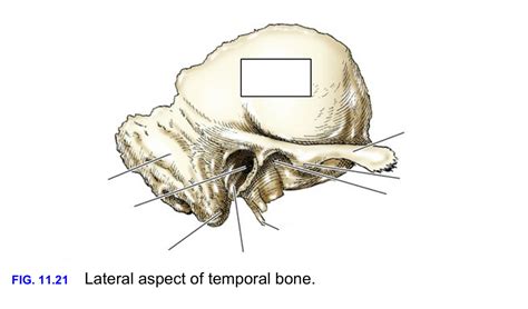Lateral Temporal Bone Diagram Quizlet