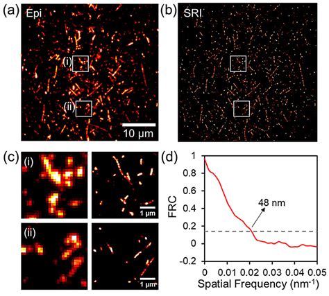 Enhanced β Amyloid Aggregation In Living Cells Imaged With Quinolinium Based Spontaneous