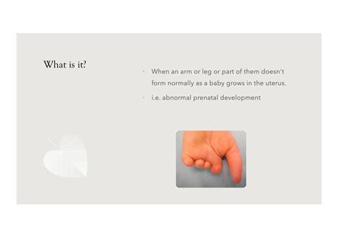 Congenital Limb Deficiencies Physiotherapy For Pediatricspdf