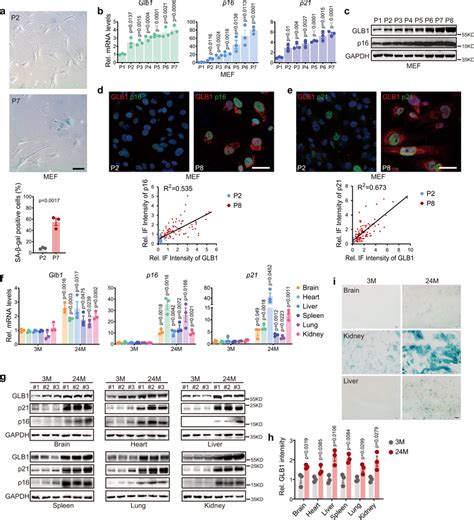 Increased Glb1 Mrna And Protein Levels In Cell And Tissue Download