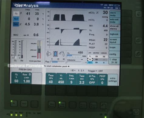 Monitor Showing Gas Analysis And Electronic Flowmeters On Anaesthesia
