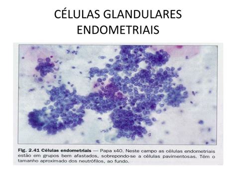 Ppt Elementos Celulares Epiteliais Presentes No EsfregaÇo Powerpoint