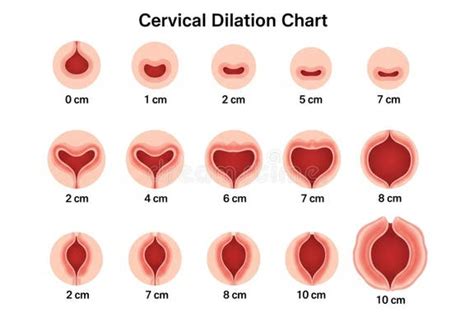 Cervical Dilation Chart Illustrating Stages Of Cervical Opening Stock