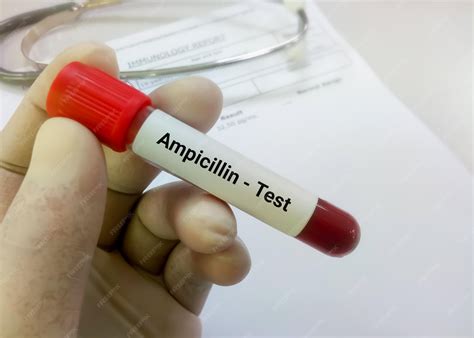 Premium Photo Blood Sample On Scientist Hand For Ampicillin Test To