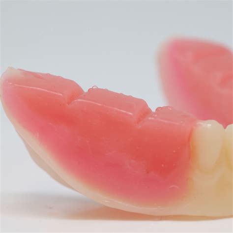 Traditional Impression Digital Denture Wax Rim Only Workflow Ed3 P